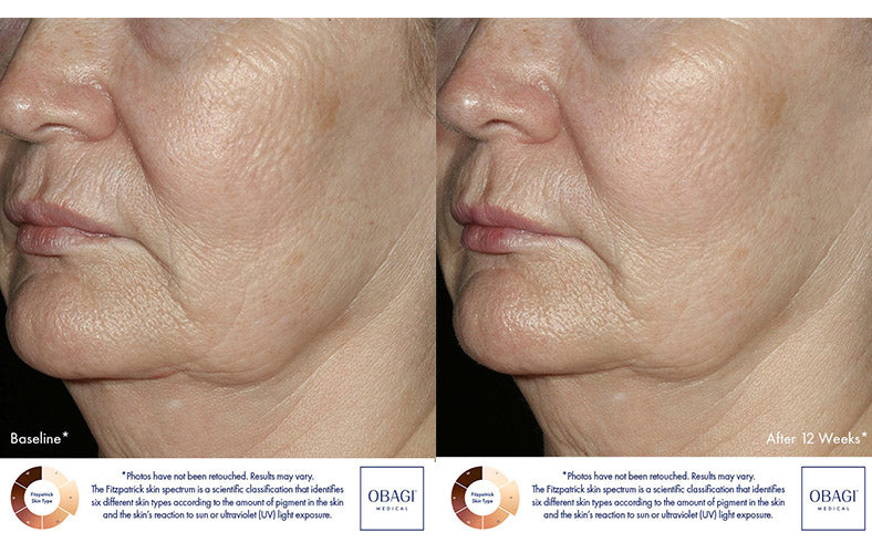 ELASTIderm® Facial Serum | Firming Facial Treatment – Obagi Philippines